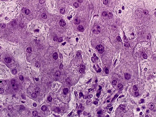 Indian Origin Scientist Who Developed World's First Human Micro Liver ...