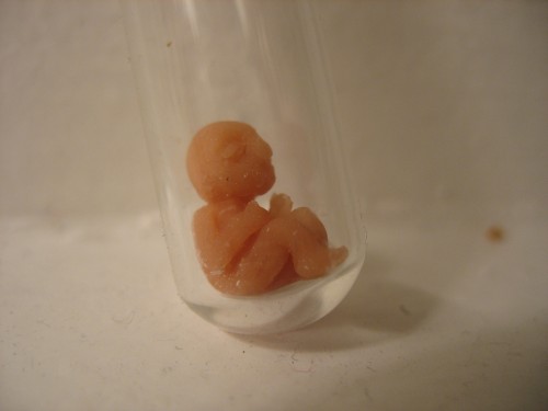 Mumbai's First Test Tube Baby Delivers A Baby Boy