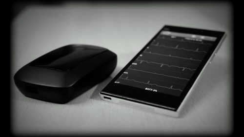 Tele-ECG Machine Made by Indian Scientists Can Help Bring Down Number ...