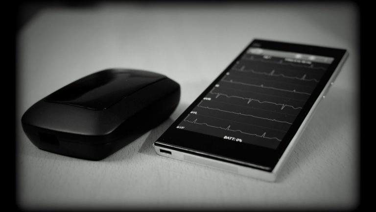 Tele-ECG Machine Made by Indian Scientists Can Help Bring Down Number ...