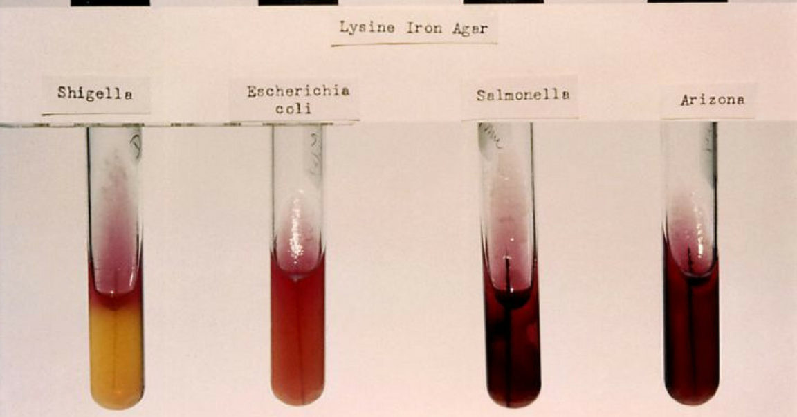Shigella in Kerala: Causes of the infection & how you can avoid it ...