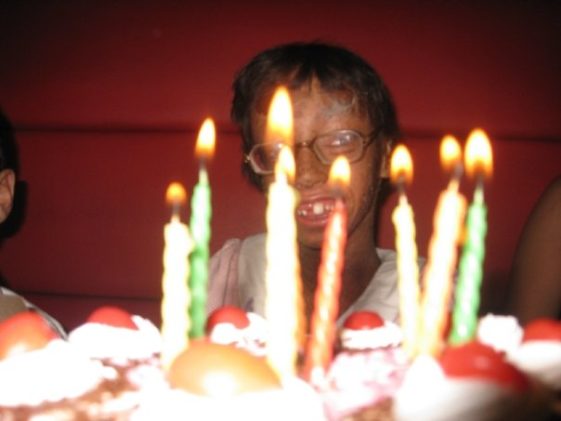 Abandoned Due to Genetic Disorder, A Mother's Love Transformed Her life