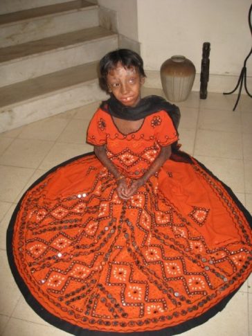 Abandoned Due to Genetic Disorder, A Mother's Love Transformed Her life