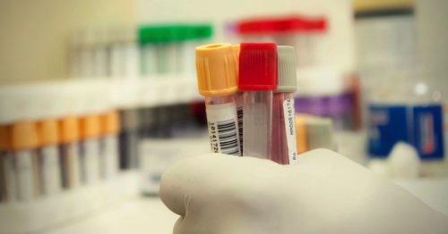 Rapid Infection Detection to Unbreakable Toilets:Startups For a Better ...