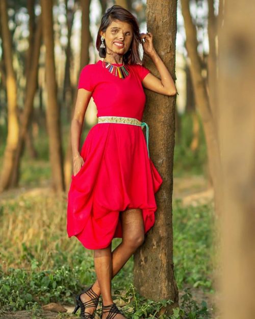 Chhapaak: 5 Acid Attack Survivors With Unbreakable Determination