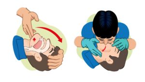 How to Perform CPR: 6 Easy Steps That Could Save a Life