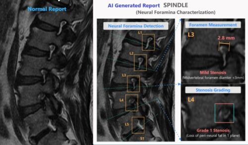Innovation Helps Radiologists Read MRIs in Under a Minute