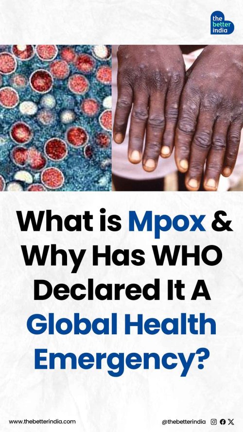 MPox: What is Monkeypox Virus & Why Has WHO Declared It a Global Health Emergency?